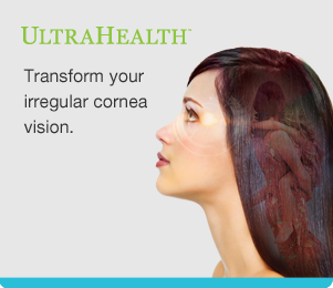 ultra-back-cons - SynergEyes